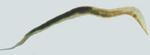 Human Pinworm