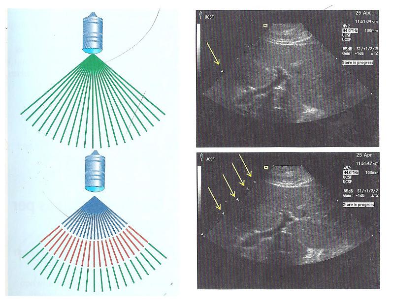 Password Required | Easy Notecards