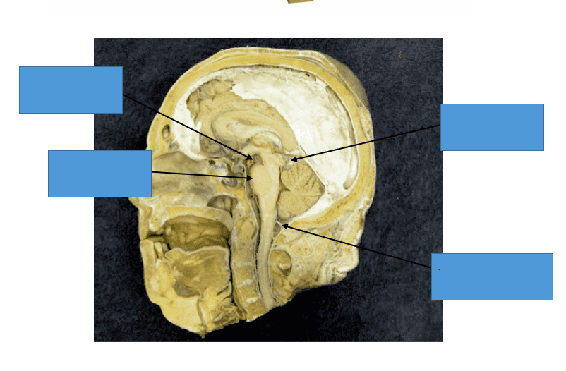 Cisternae Pronunciation