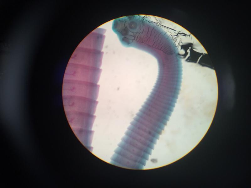 Taenia Coli Anatomy