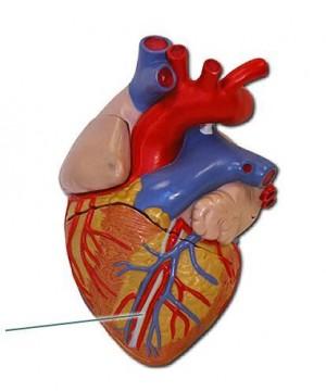 Interventricular Septum Model