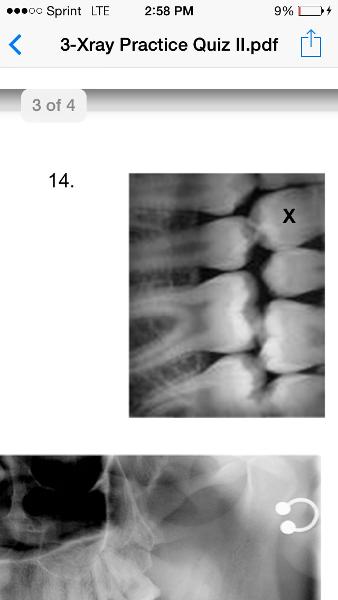 Xray 1 18 2